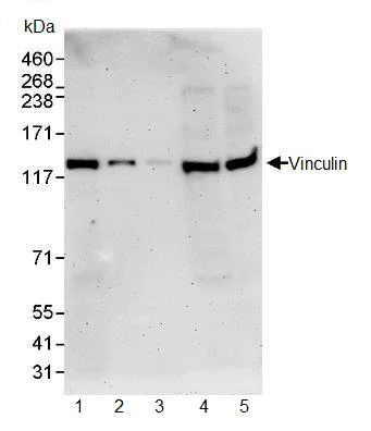 Vinculin antibody, rabbit polyclonal (ab91459) | Abcam
