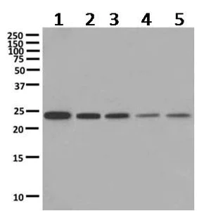 Anti-VPS28 antibody [EPR9881(B)] - BSA and Azide free (ab249413) | Abcam
