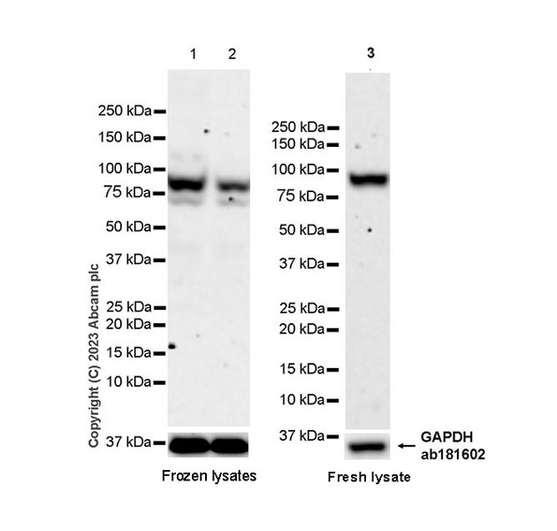 Anti-VPS52 antibody [EPR27031-70] (ab313785) | Abcam