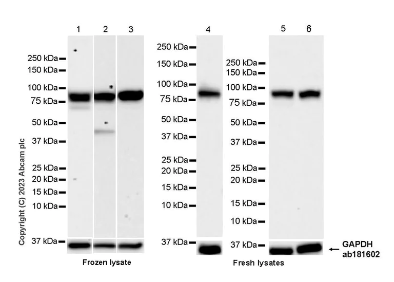 Anti-VPS52 antibody [EPR27031-70] (ab313785) | Abcam