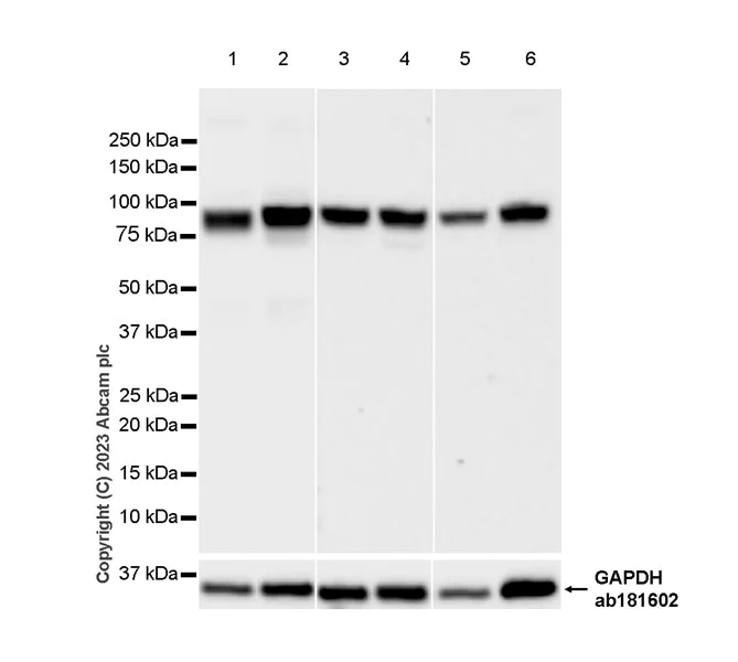 Anti-VPS52 antibody [EPR27031-70] (ab313785) | Abcam