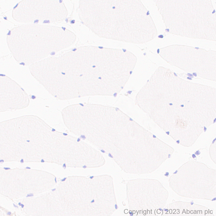 Anti-VSV-G tag antibody [EPR28362-204] (ab309106) | Abcam