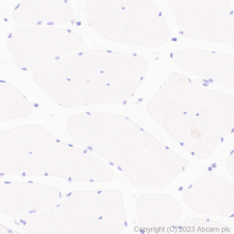 Anti-VSV-G tag antibody [EPR28362-204] (ab309106) | Abcam