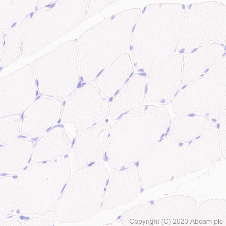 Anti-VSV-G tag antibody [EPR28362-204] (ab309106) | Abcam