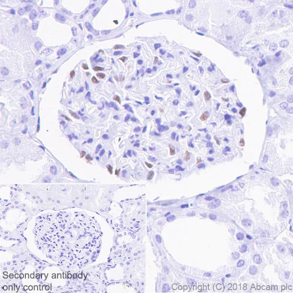Anti-Wilms Tumor Protein antibody [CAN-R9(IHC)-56-2] (ab89901) | Abcam