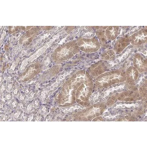 Anti-WNK1 antibody [HL2184] (ab317155) | Abcam中文官网