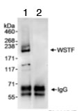 Anti-WSTF antibody (ab70263) | Abcam