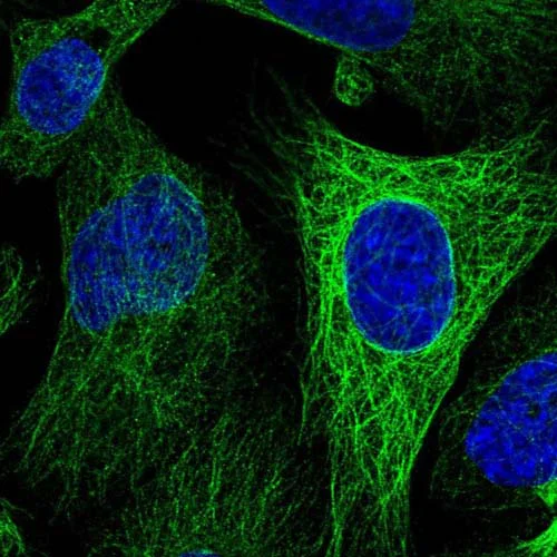 Anti-WWC2 antibody (ab126356) | Abcam