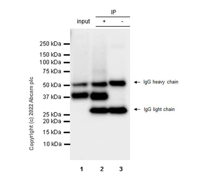 Anti-xCT antibody [3A12] (ab300667) | Abcam