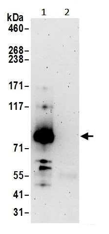 Anti-XPB antibody (ab245538) | Abcam