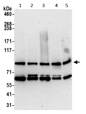 Anti-XPB antibody (ab245538) | Abcam