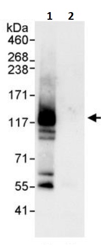Anti-XPC antibody (ab245385) | Abcam