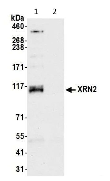 Anti-XRN2 antibody (ab72181) | Abcam