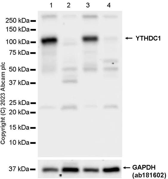 Anti-YTHDC1 antibody [RM1107] (ab316216) | Abcam