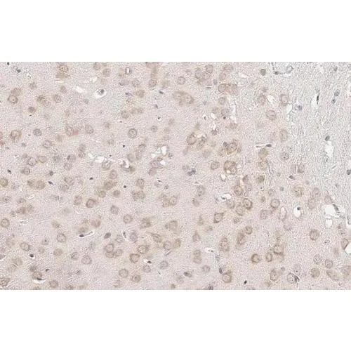 Anti-YTHDF3 antibody [HL2235] (ab317173) | Abcam