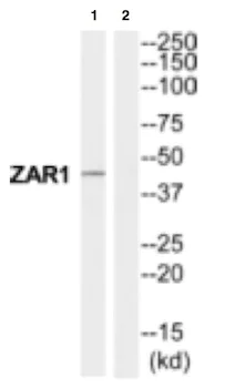 ZAR1抗体 (ab129875)| Abcam中文官网