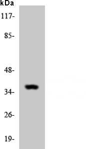 ZDHHC4/DC1抗体 (ab235369)| Abcam中文官网