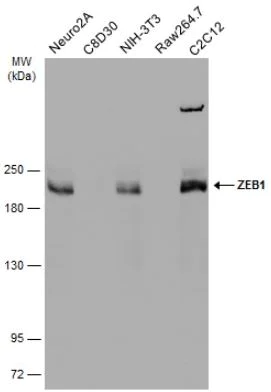 Anti-ZEB1 antibody (ab155249) | Abcam