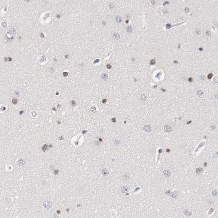 Anti-ZEB2 antibody (ab223688) | Abcam