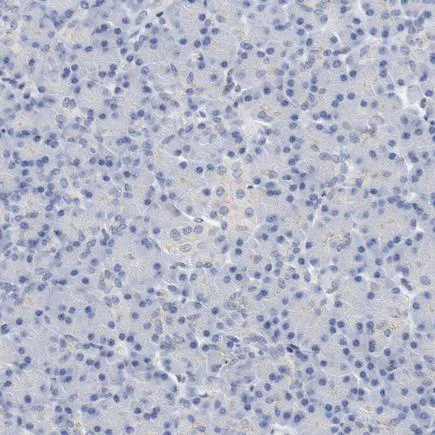 Anti-ZEB2 antibody (ab223688) | Abcam