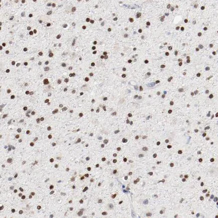 Anti-ZEB2 antibody (ab223688) | Abcam