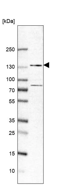 Anti-ZFR antibody (ab272572) | Abcam