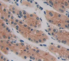 Anti-ZG16B antibody (ab231334) | Abcam