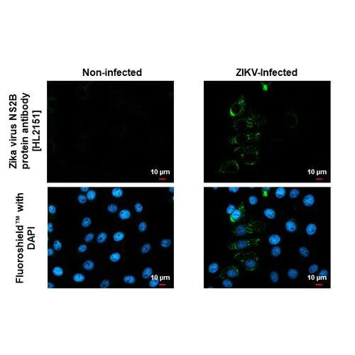 Anti-Zika virus NS2B protein antibody [HL2151] (ab317146) | Abcam中文官网