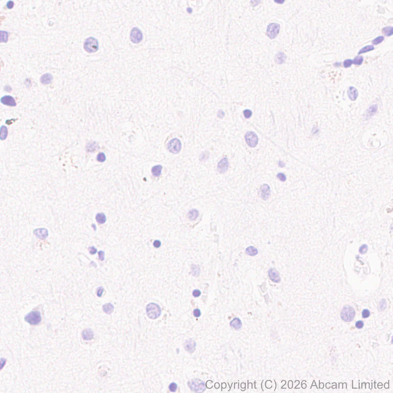 Anti-Zika Virus NS3 antibody [EPR30865-536] (ab326723) | Abcam