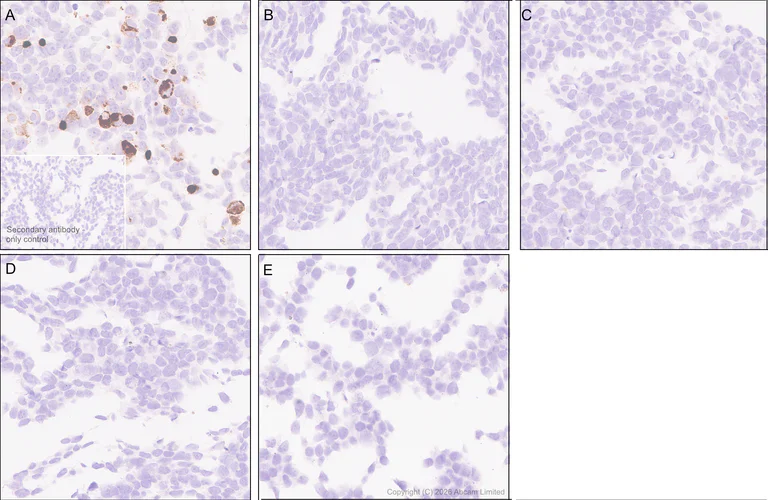Anti-Zika Virus NS3 antibody [EPR30865-536] (ab326723) | Abcam