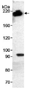 Anti-ZMYM3 antibody (ab19165) | Abcam