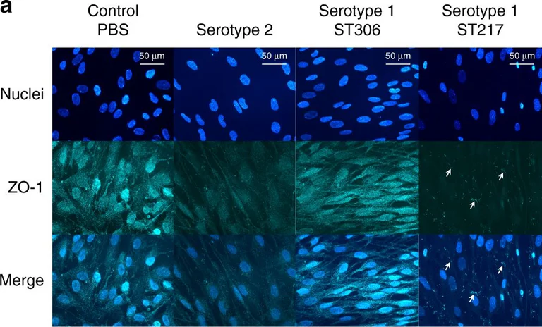 ZO1 tight junction protein抗体 (ab96587)| Abcam中文官网