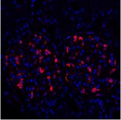 Anti-ZO1 tight junction protein antibody [BLR092G] (ab276131) | Abcam