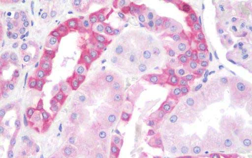 Anti-ZO1 tight junction protein antibody - C-terminal (ab190085) | Abcam